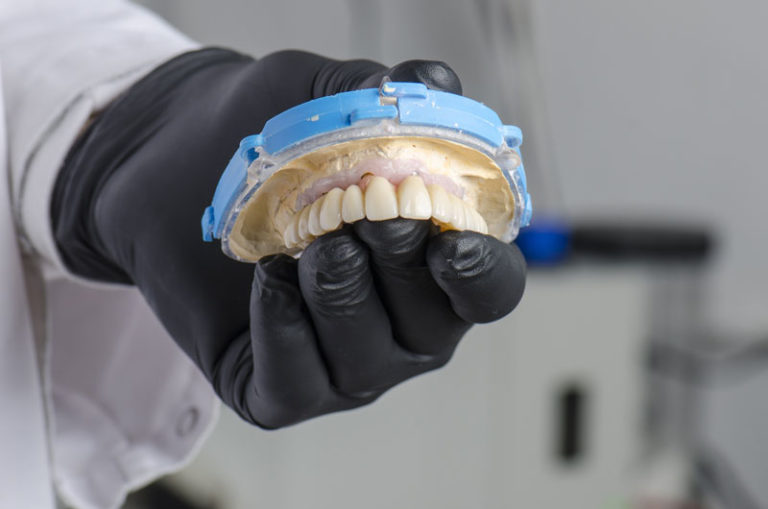 How Do I Finance My Full Arch Dental Implants? - Fusion Implant Center